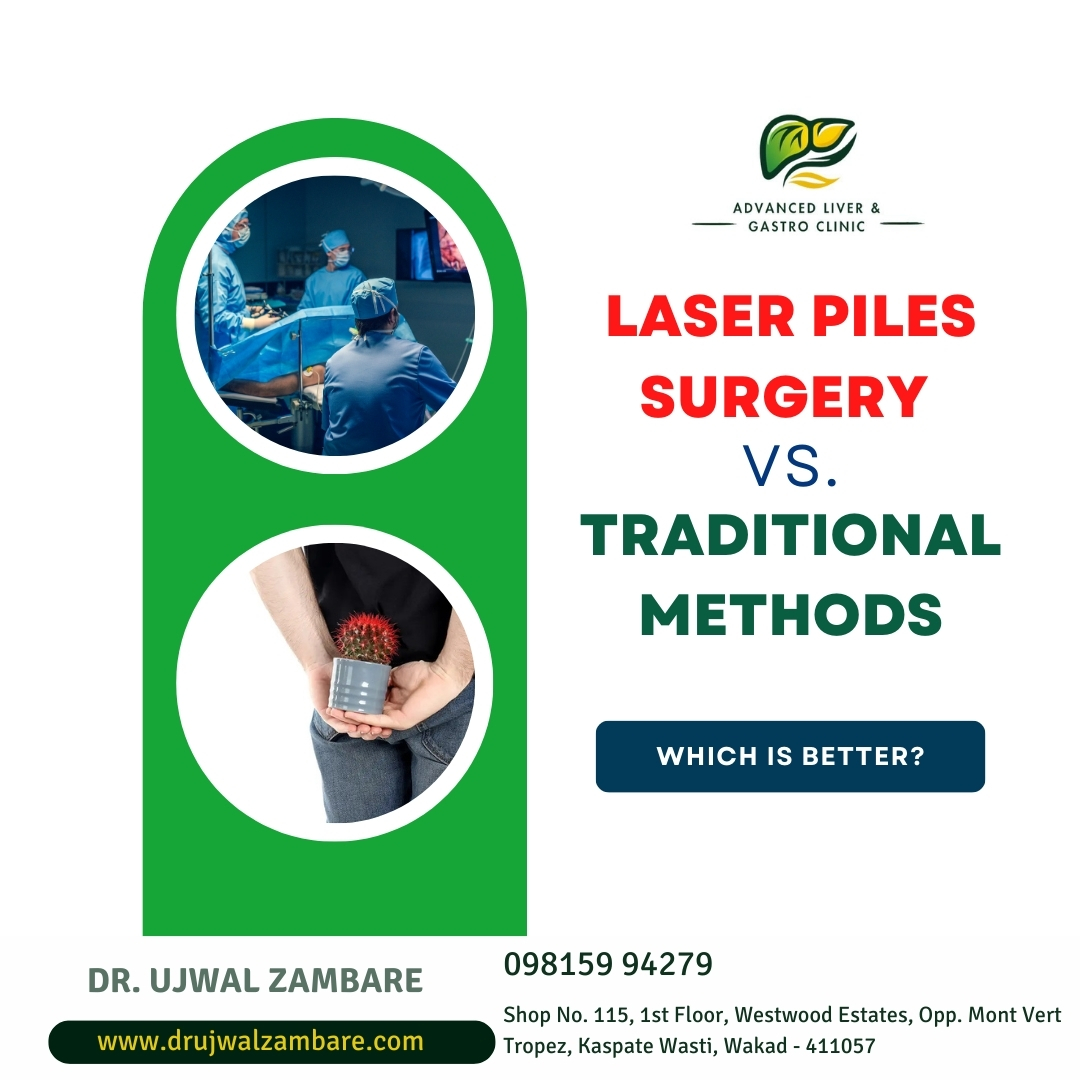Laser Piles Surgery vs. Traditional Surgery | Dr. Ujwal Zamabre