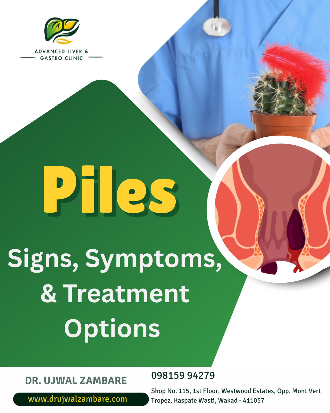 Piles Sign and Symptoms | Piles Specialist | Dr. Ujwal Zambare